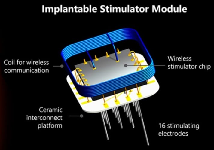 The Power of Brain Implants - Atlantic International University